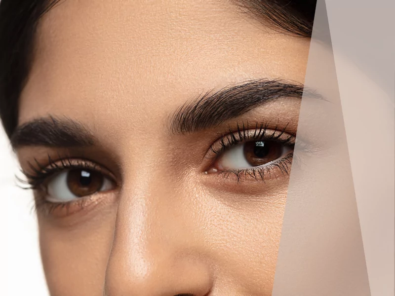 Global Eyecon - Beautify Me Medical Center